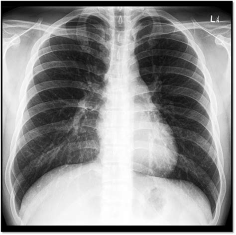Differential Absorption Flashcards Quizlet