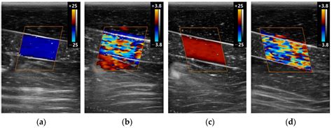 Development And Evaluation Of Doppler Ultrasound Training Phantom For
