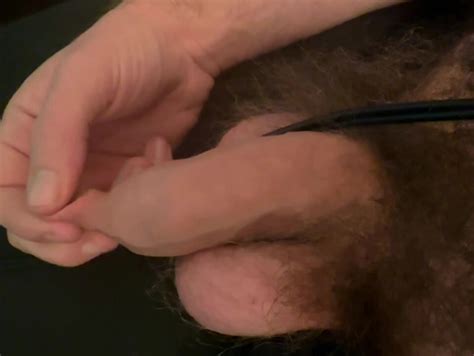 My Smegma Covered Foreskin A Reason Why We Circumcise