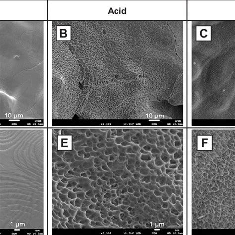 Surface Structure Of Samples In Scanning Electron Microscopy Images A