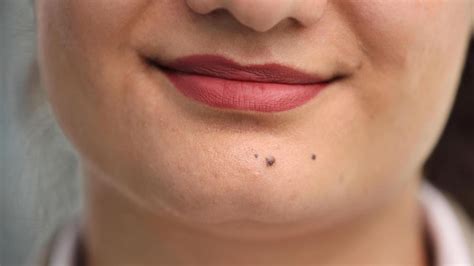 Moles On Lips Spiritual Meaning 7 Messages For You