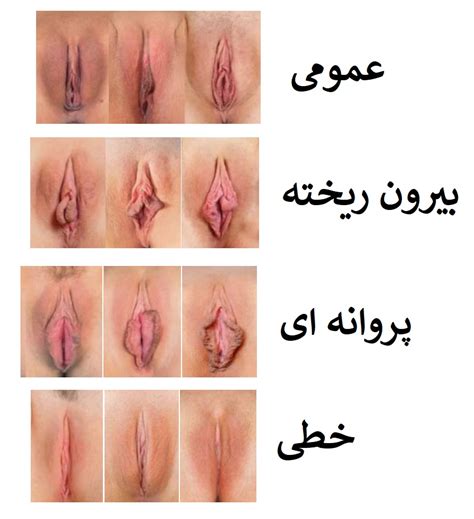 کص شناسی پیشرفته انواع کص