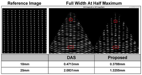 A Channel High Resolution Ultrasound Beamforming System For Ultrasound Endoscopy Applications