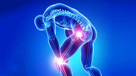 How To Diagnose Joint Pain Health Policy Monitor