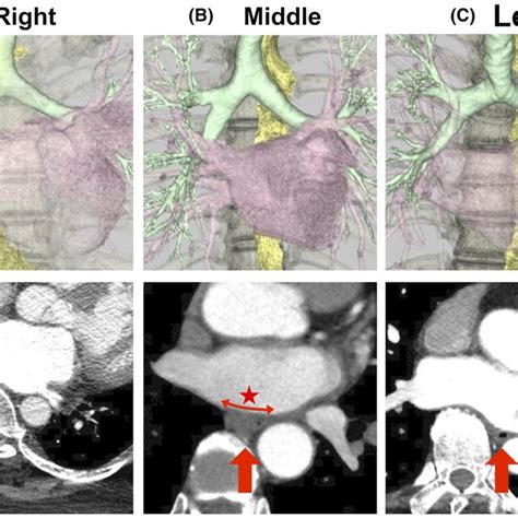 Anatomical Classification Of The Esophagus The Images Above Are