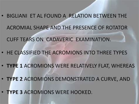 Shoulder Pathologies In Young Active Persons Pptx