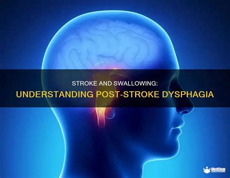 Stroke And Swallowing Understanding Post Stroke Dysphagia Medshun