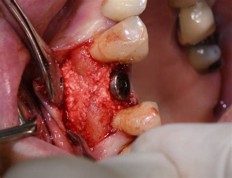 Ethoss Case Studies Swallow Dental