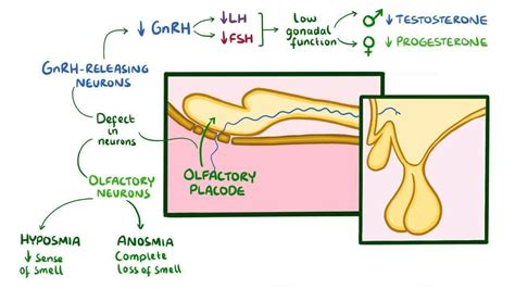 Síndrome De Kallmann Vídeo Anatomía And Definición Osmosis