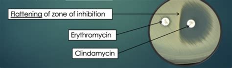 Lincosamides Exam 2 Flashcards Quizlet