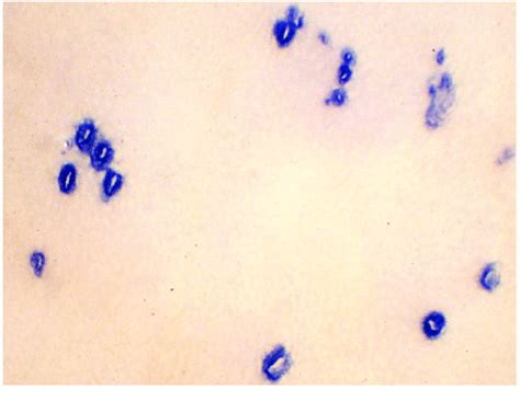 Alkaline Phosphatase Active Stomach Download High Resolution