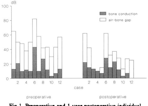 Figure 1 From Classification Of Congenital Middle Ear Anomalies Report