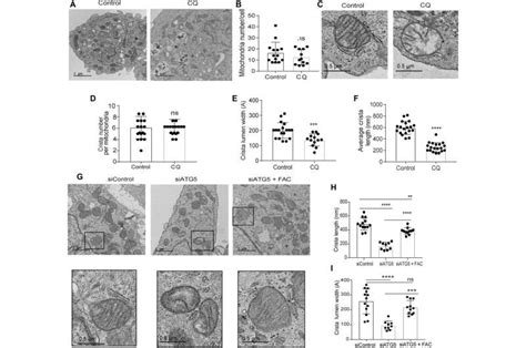 Inhibiting The Biological Crosstalk Of Autophagy And Mitochondrial