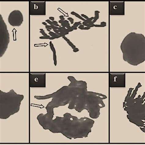 Cas Induced By Uranyl Acetate Mn In Interphase A Fragment In Download Scientific Diagram