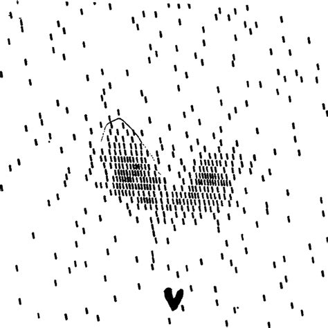 Thyroid Scintiscan 131 I 50 Ci In The Propositus A K545 Collimator