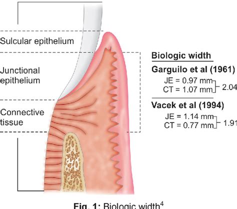 Biologic Width