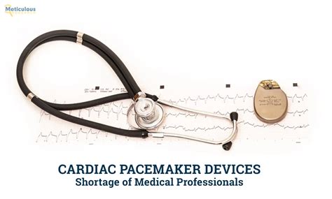 Cardiac Pacemaker Market Archives Meticulous Blog