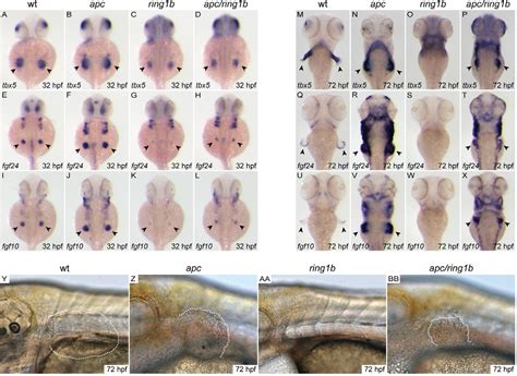 Figure 8 From The Polycomb Group Protein Ring1b Is Essential For