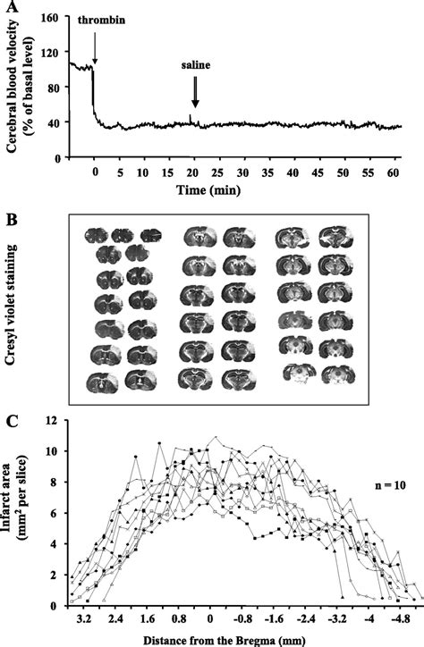 Mouse Model Of In Situ Thromboembolic Stroke And Reperfusion Stroke