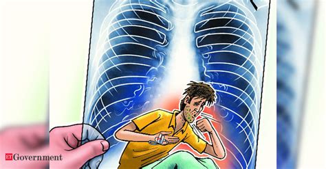 Algorithm Tech To Detect Tuberculosis By Listening To The Sound Of Cough Etgovernment