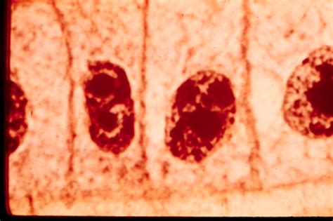 Msu Bio Lecture Exam 3 Cancer Dna And Cell Cycle Flashcards Quizlet