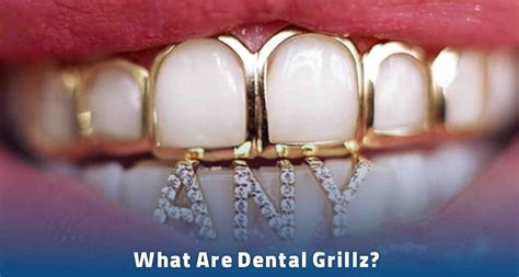 What Are Dental Grillz