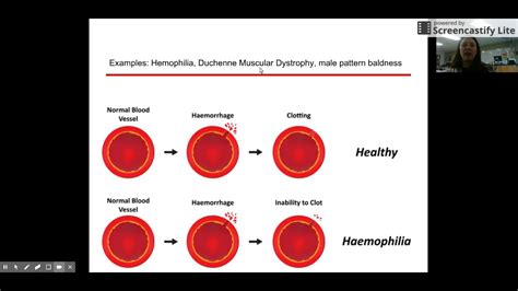 Biology 2 Unit 1 Mendel Video 6 Sex Linked Traits Youtube