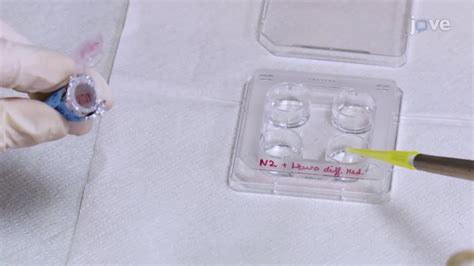 视频 Immunofluorescence Microscopy Of Neural Cells Differentiated From