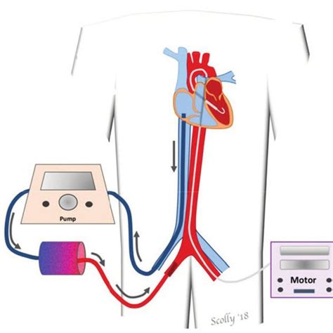 Survival By Ecmo Modality Blue Line Vv Venovenous Green Line Va