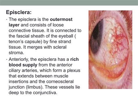 Anatomy Of Sclera Pptx