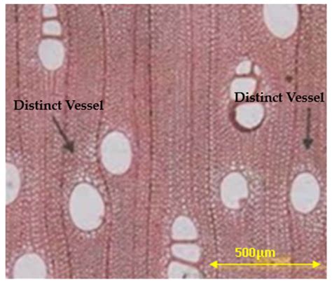 Anatomical Structure Of Acacia Mangium—cross Section 9 Download