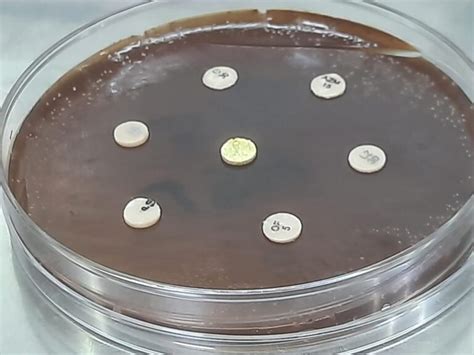 Aerococcus Viridans Introduction Morphology Pathogenicity Lab