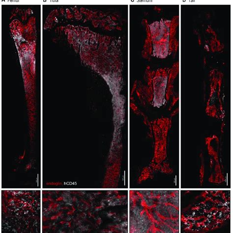 Figure S2 Leukemic Engraftment In The Mouse Bone Marrow Images Are Download Scientific