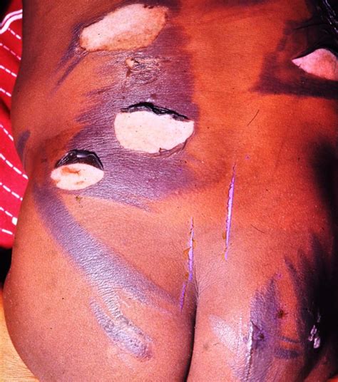 Iatrogenic 1 Clinical Eye Openers