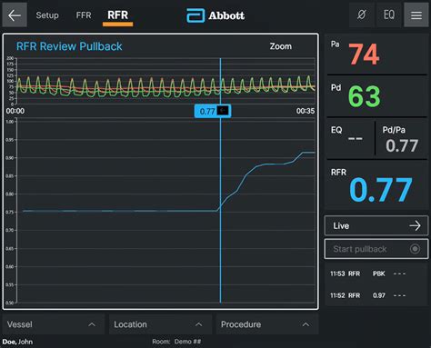 Abbott Ultreon Software For Physiology Assessment Pci Abbott