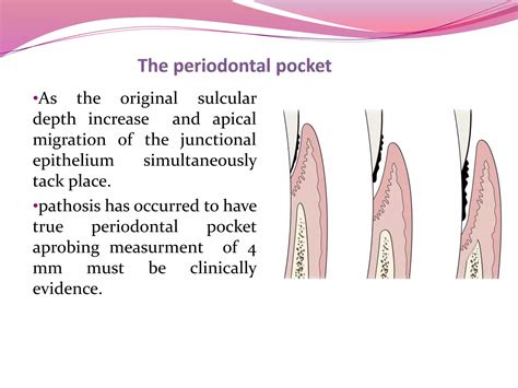 Dentinogingival Junction Pptx