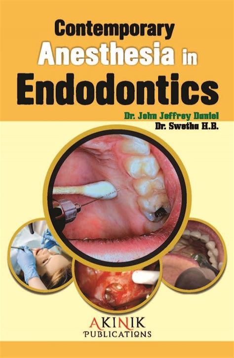 Endodontics Definition Dictionary At Melissa Trexler Blog