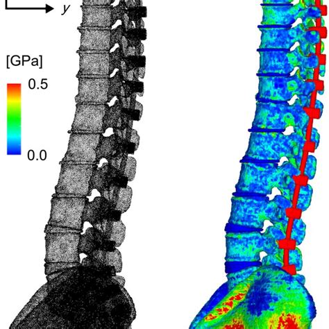 Element Segmentation Diagram Of Multi Vertebrae And Youngs Modulus