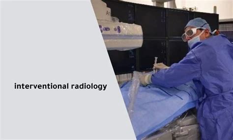 What Does Interventional Radiology Do London Interventional Radiology