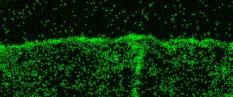 Colloidal Matter School Of Physics University Of Bristol