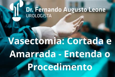 Vasectomia Cortada E Amarrada Entenda O Procedimento Dr Fernando