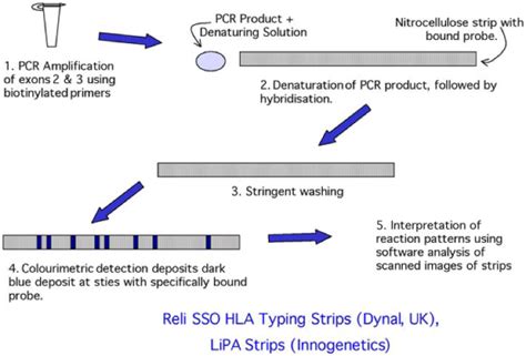 Hla Typing And Its Influence On Organ Transplantation Springerlink