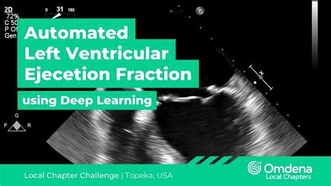 Automated Left Ventricular Ejection Fraction Assessment Using Deep Learning Youtube