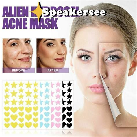 Jual Acne Patch Jerawat Pimple Patch Repsir Skin Acne Pimple Masker