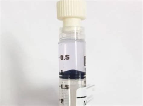 Trabeculectomy With Mitomycin