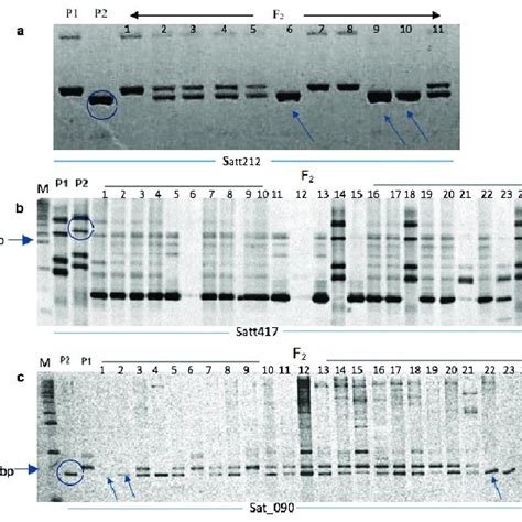 Colorimetric Assay Of Soybean Seed Lipoxygenase Enzymes For Soybean In
