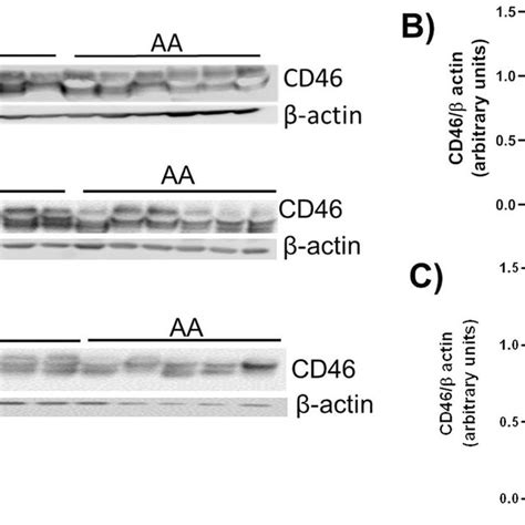 Alternative Pathway 50 Ap50 And Classical Pathway 50 Ch50 Values Of