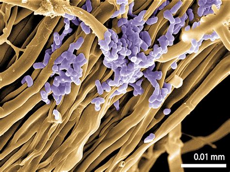 An Ecological Solution Against Pathogenic Fungi Bio Eco Actual