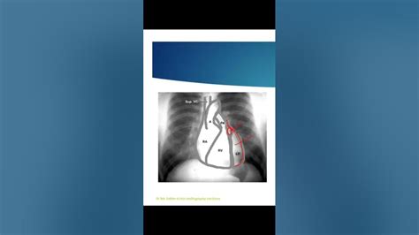 اکسری صدر؛ درس سوم عنوان تفسیر اکسری صدر برای اشتراک در درس سوم پیام کنید 0784192010 Youtube