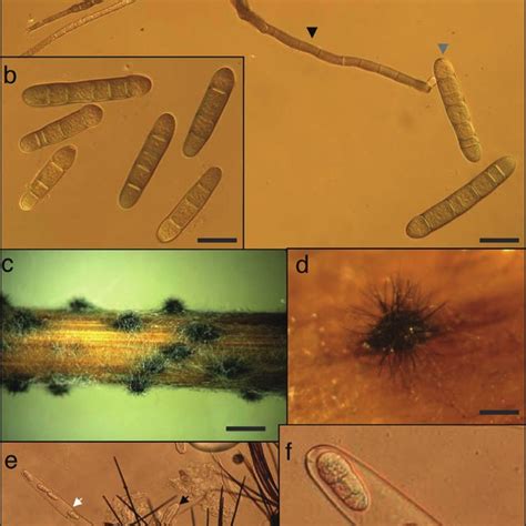 Pdf Pyrenophora Teres Profile Of An Increasingly Damaging Barley
